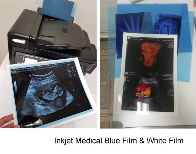 A4 A3 Digital Inkjet Medical Ultrasound Film White Medical Film For X Ray