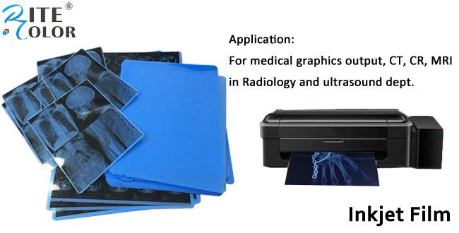 Inkjet Blue Radiology Medical Imaging Film