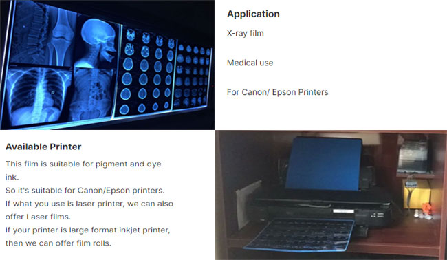 Inkjet Printing PET Blue Medical Film For X Ray A4 8x10 14x17 Sheets